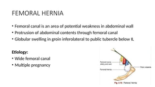 femoral hernia anatomy presentation.pptx