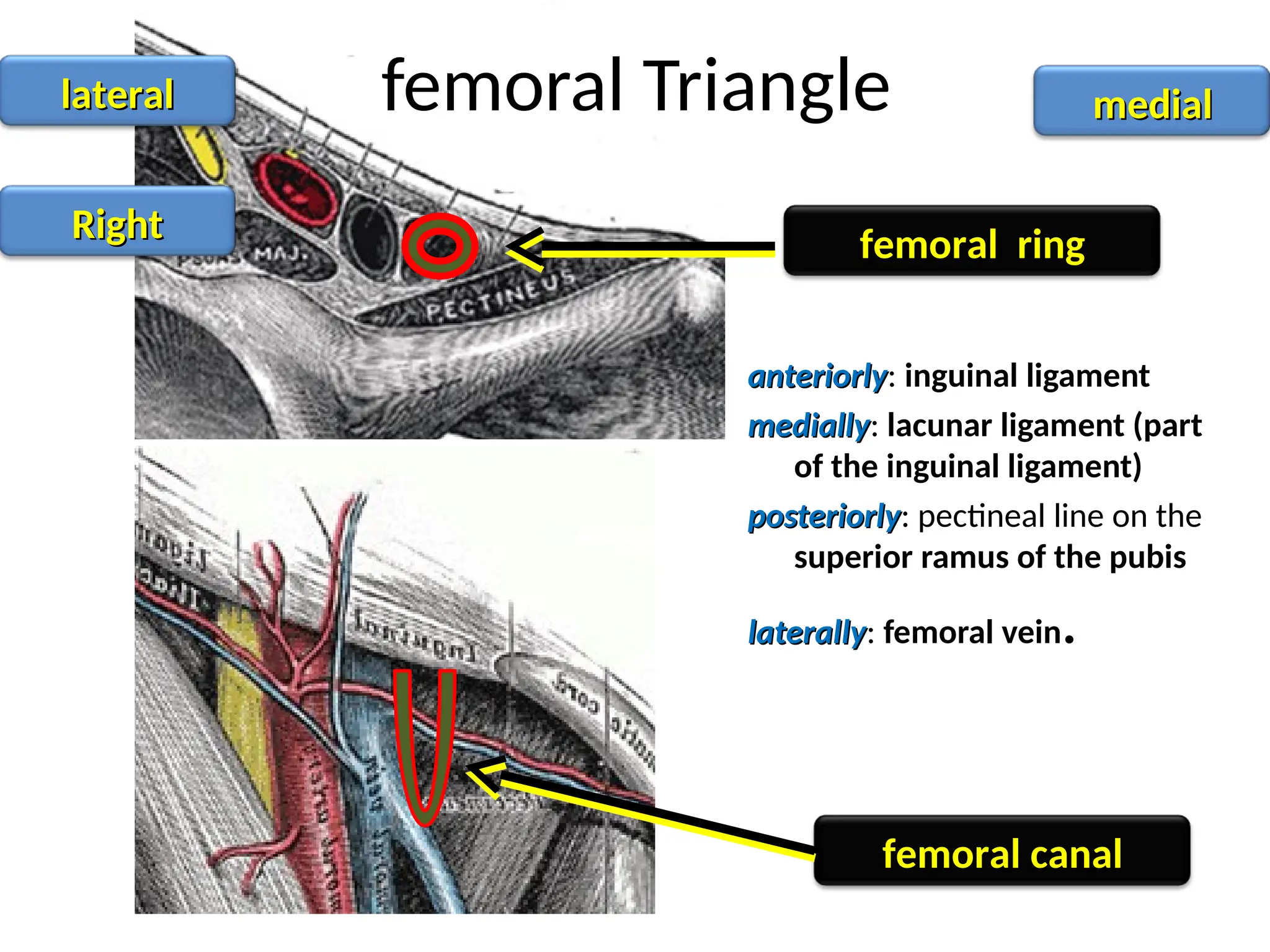 ---fsdffemoral-hernia4627-160120091851.ppt