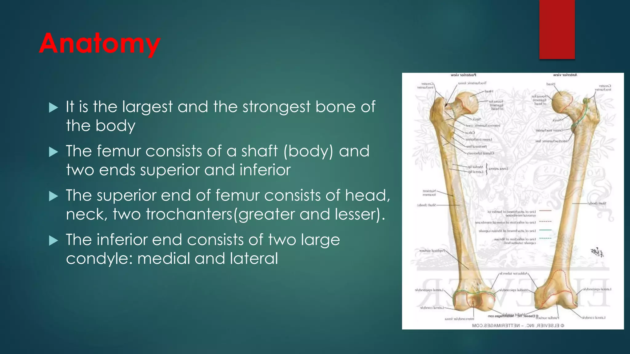 Femoral shaft-fractures | PPT