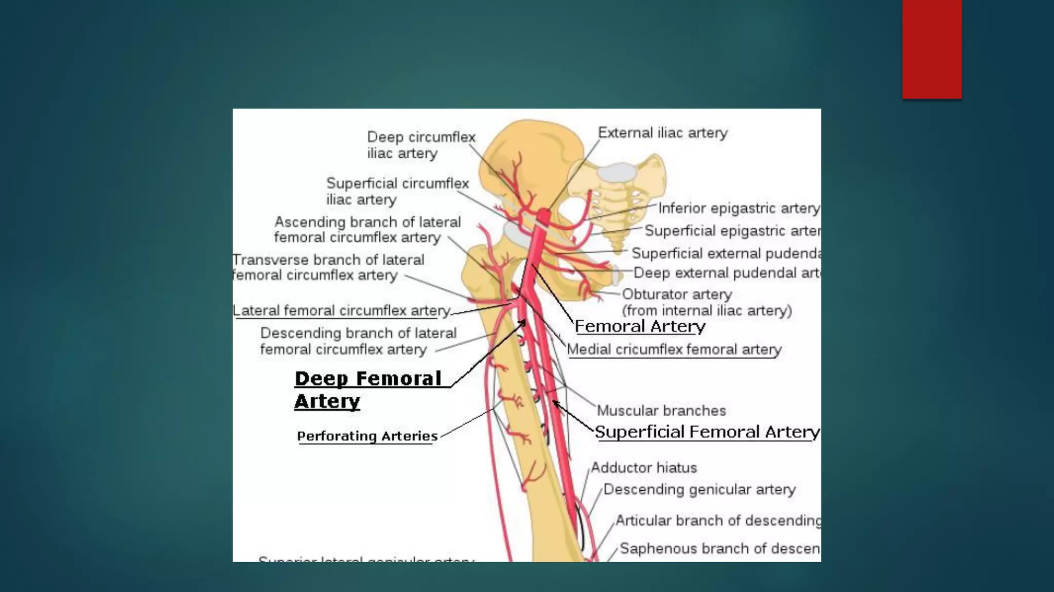 Femoral shaft-fractures | PPT