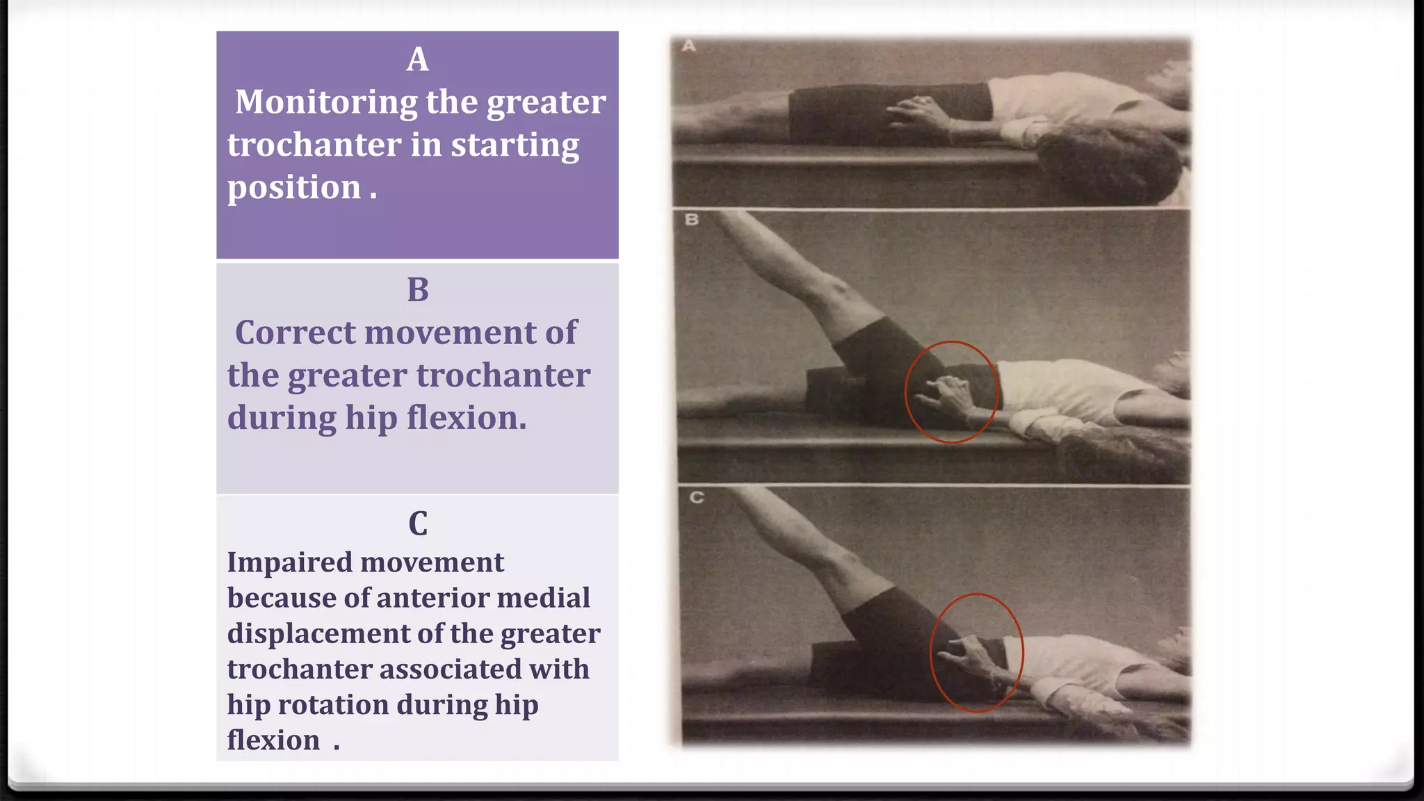 Femoral anterior glide syndrome | PDF
