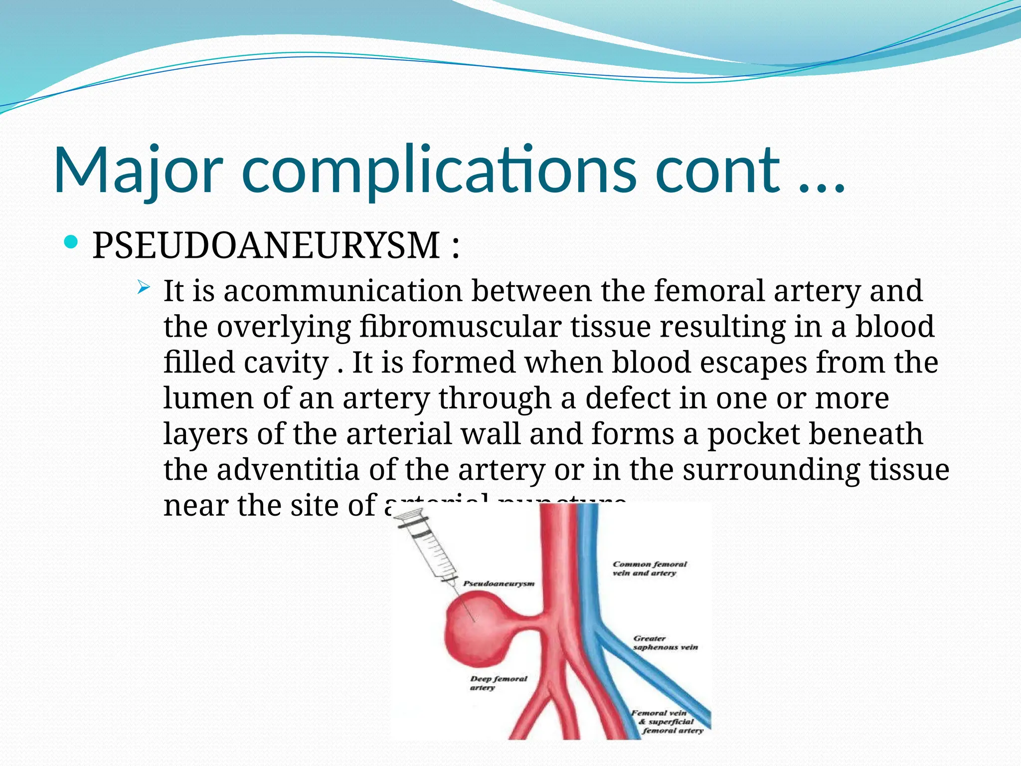 Femoral Artery Access for catheterization procedureure.pptx