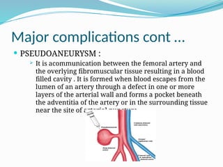 Femoral Artery Access for catheterization procedureure.pptx