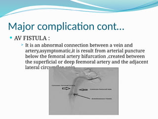 Femoral Artery Access for catheterization procedureure.pptx