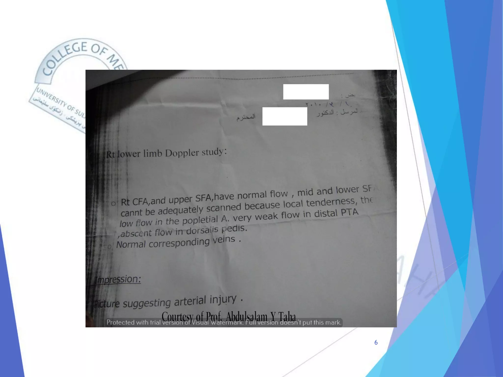 Femoral Artery Injury associated with Fracure Femur.pdf
