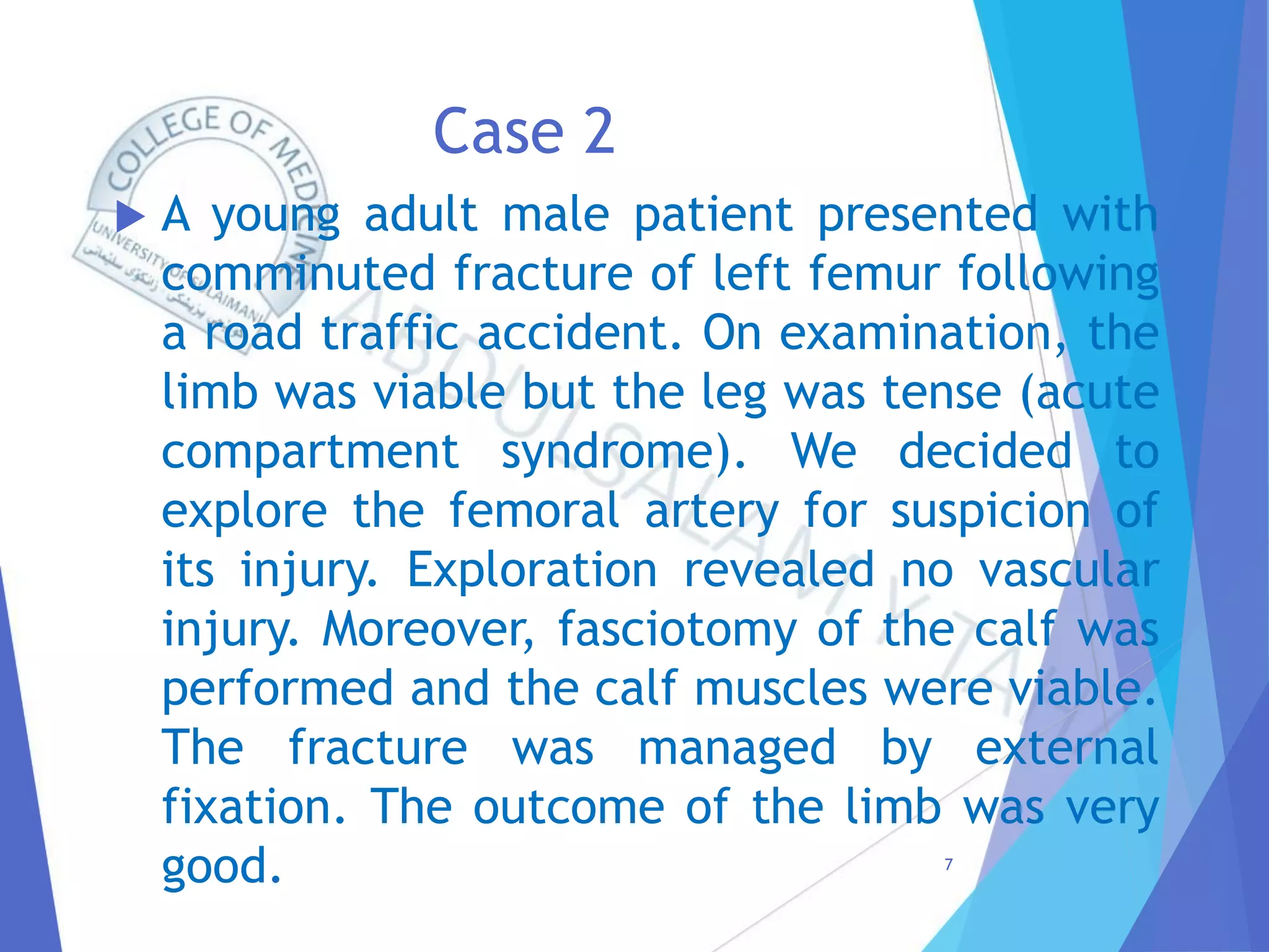 Femoral Artery Injury associated with Fracure Femur.pdf