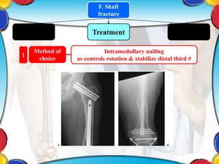 Femoral bone fracture | PPTX | Death, Injury, or Military Conflict ...
