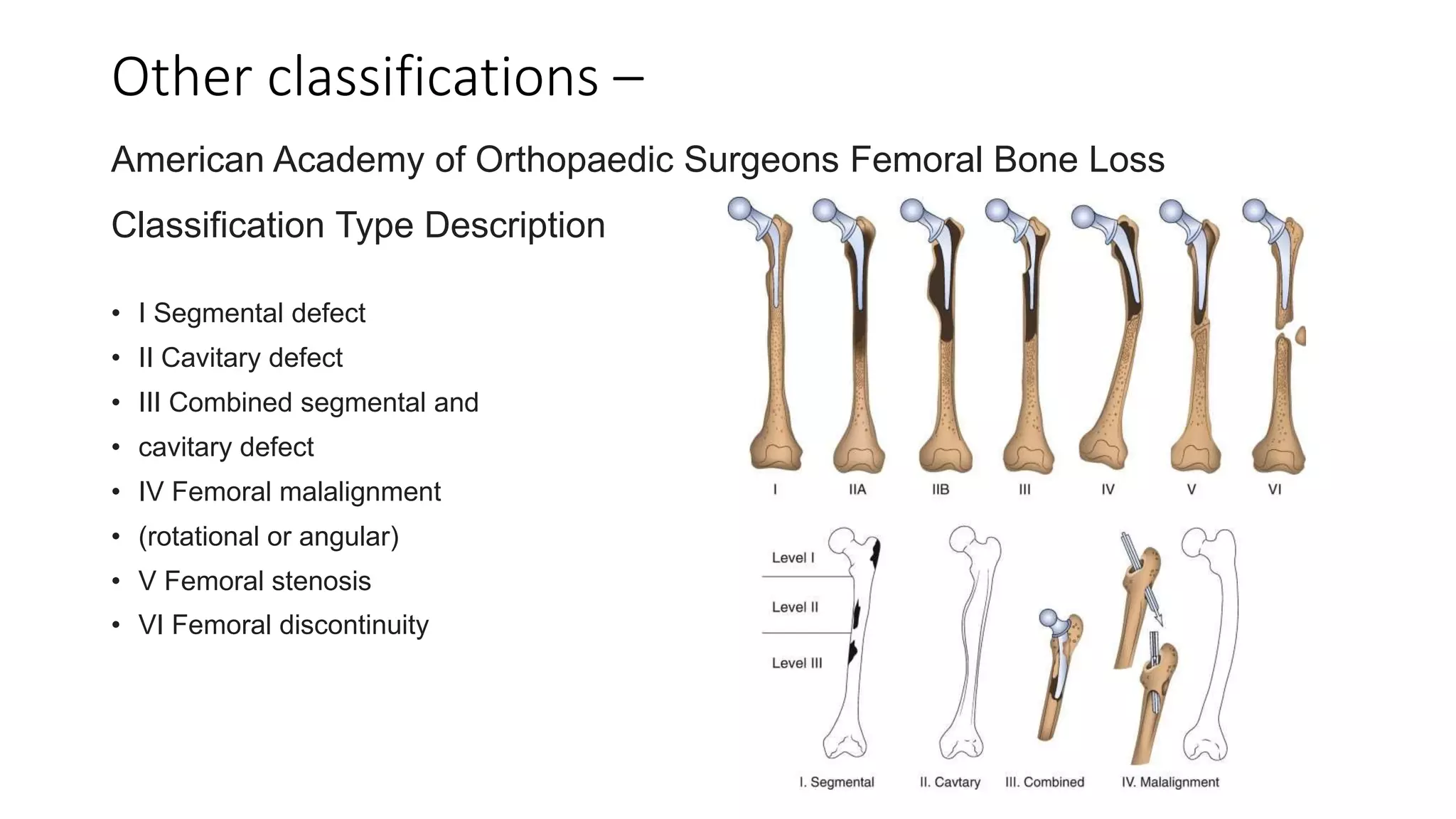 femoral bone assessment.pptx