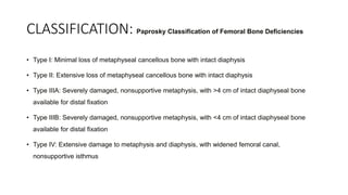 femoral bone assessment.pptx