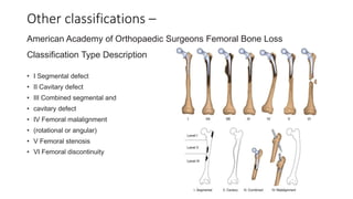 femoral bone assessment.pptx