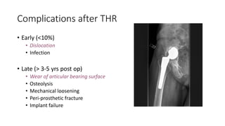femoral bone assessment.pptx