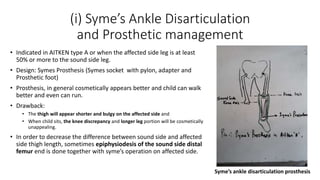 Femoral deficiency and Prosthetic management (part 2.pptx