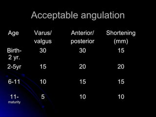 Femoral fractures in children | PPT