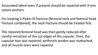 safe surgical dislocation for treatment of femoral head fracture.pptx