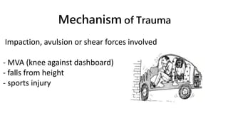 safe surgical dislocation for treatment of femoral head fracture.pptx