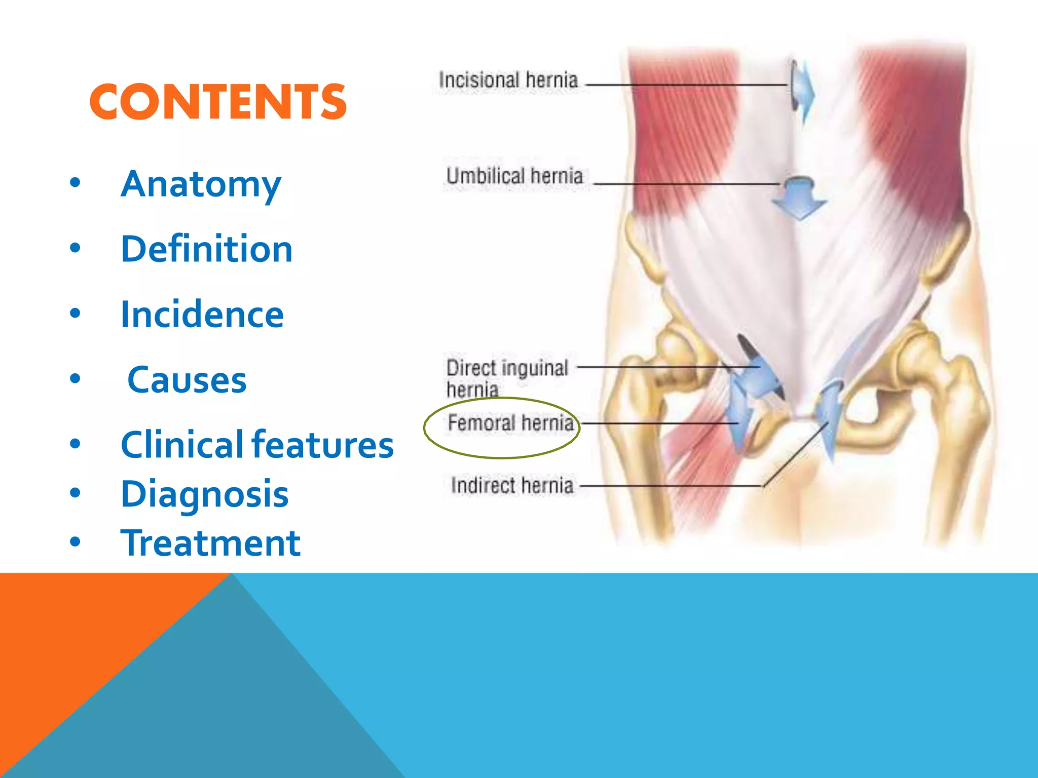 Femoral hernia | PPTX