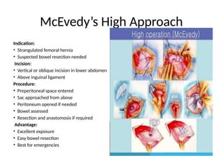 FEMORAL HERNIA ppt for surgical ward ace | PPTX