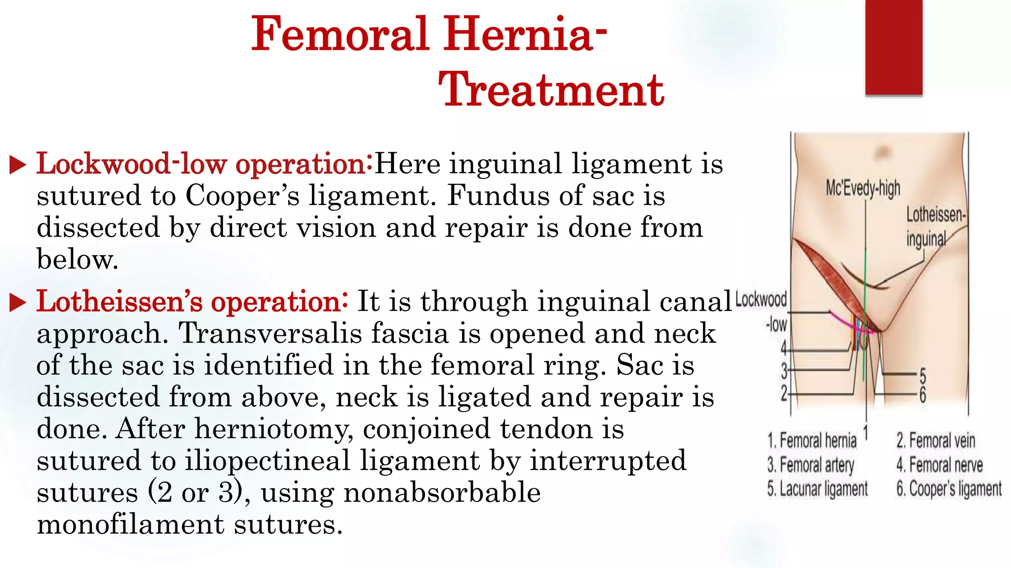 Femoral hernia - Groin swellings | PPTX