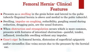 Femoral hernia - Groin swellings | PPTX
