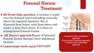 Femoral hernia - Groin swellings | PPT