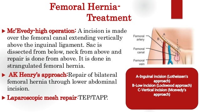 Femoral hernia - Groin swellings