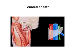Femoral hernia lec to 1st year | PPT