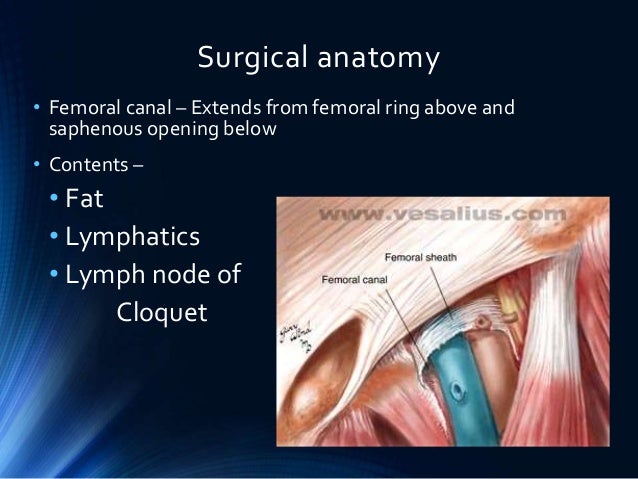 Femoral hernia presentation for cbl