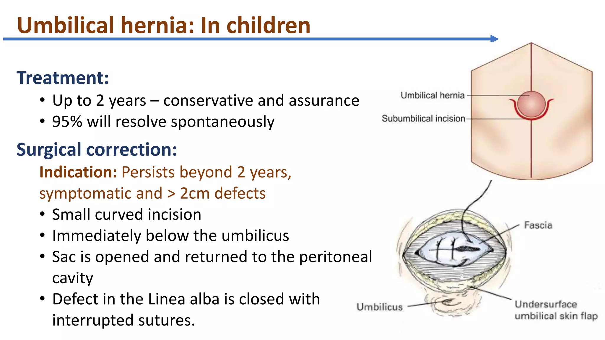 Femoral hernia with umbilical hernia | PPTX