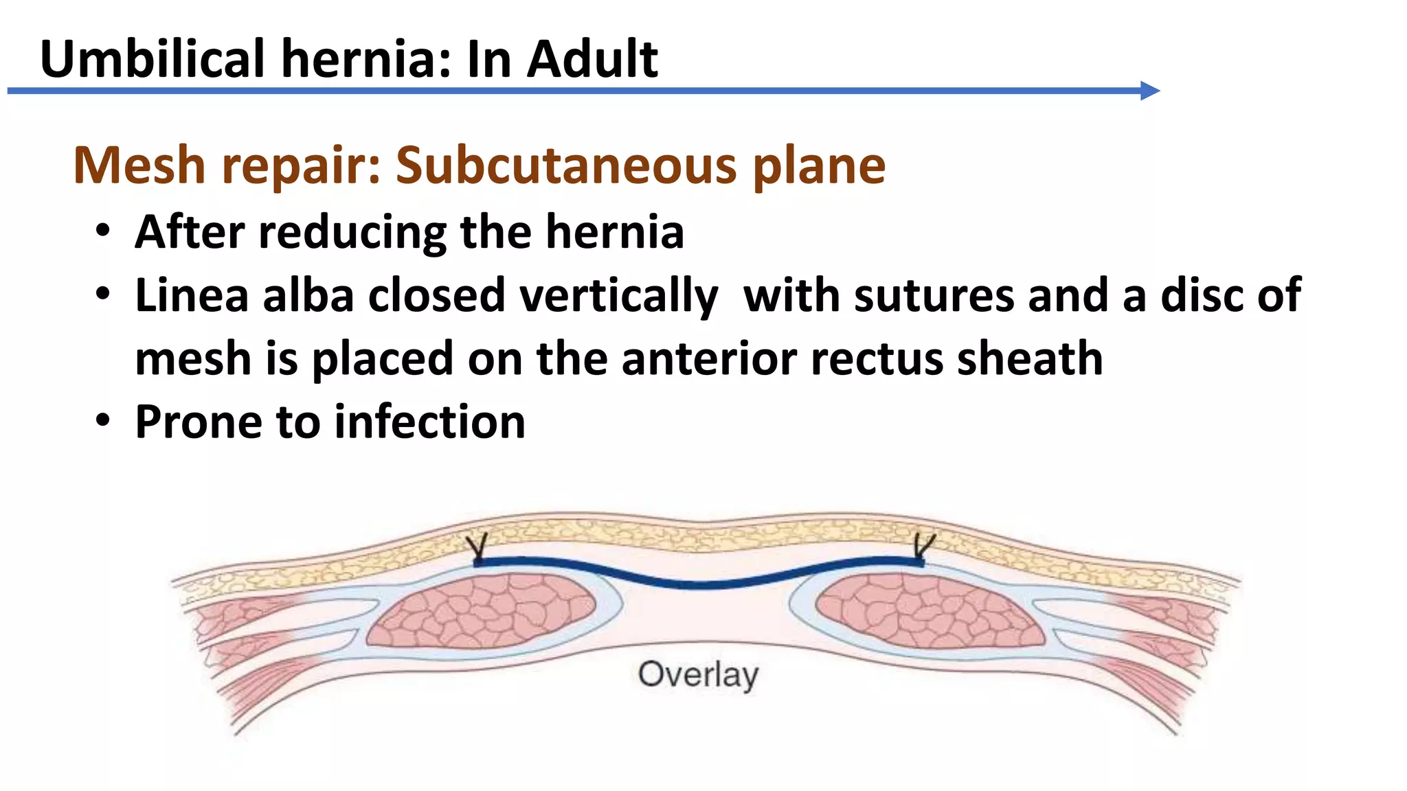 Femoral hernia with umbilical hernia | PPTX | Pregnancy | Reproductive ...