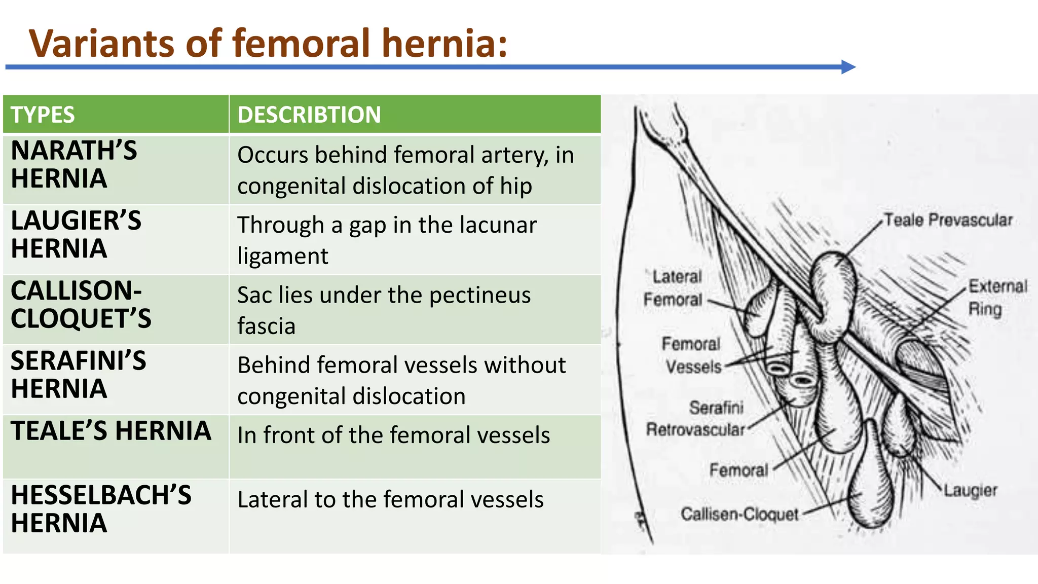 Femoral hernia with umbilical hernia | PPTX