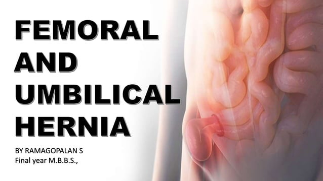 Femoral hernia with umbilical hernia | PPT