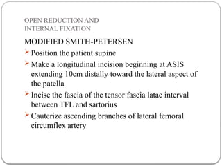 Femoral Neck fracture and it's Management | PPTX
