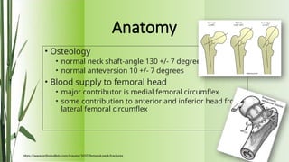 Femoral Neck Fracture-Orthopaedi and Traumatologi.pptx