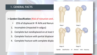 (Orthopedics) Femoral neck fractures (Anatomy, pathophysiology and ...