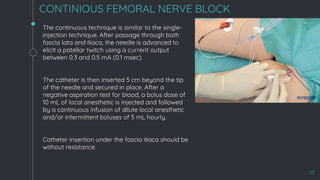 FEMORAL NERVE BLOCK'.pptx