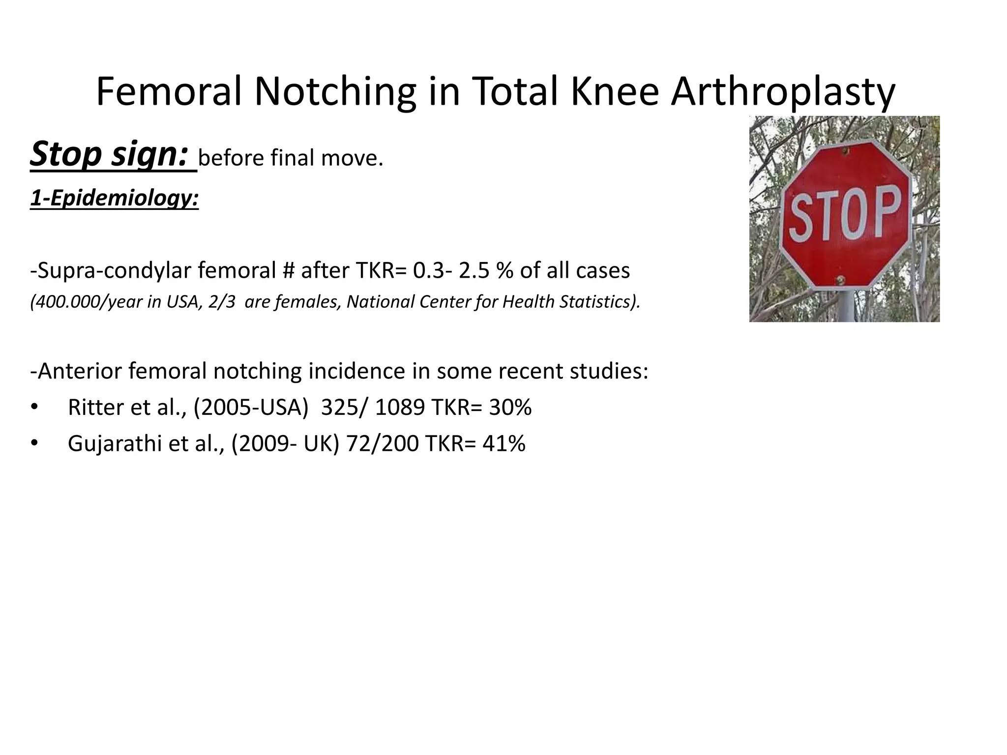 Femoral notching in total knee arthroplasty | PPTX | Bone and Joint ...