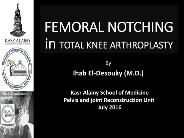 Femoral notching in total knee arthroplasty | PPTX | Bone and Joint ...