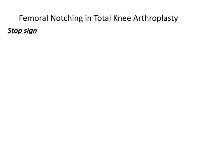 Femoral notching in total knee arthroplasty | PPT