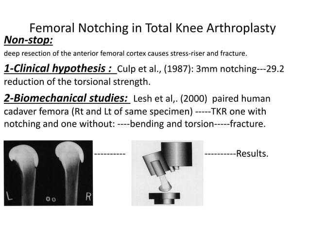 Femoral notching in total knee arthroplasty | PPTX | Bone and Joint ...