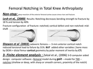 Femoral notching in total knee arthroplasty | PPTX