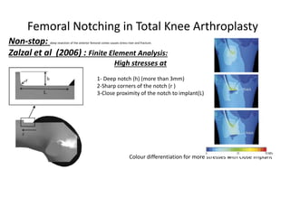 Femoral notching in total knee arthroplasty | PPTX | Bone and Joint ...