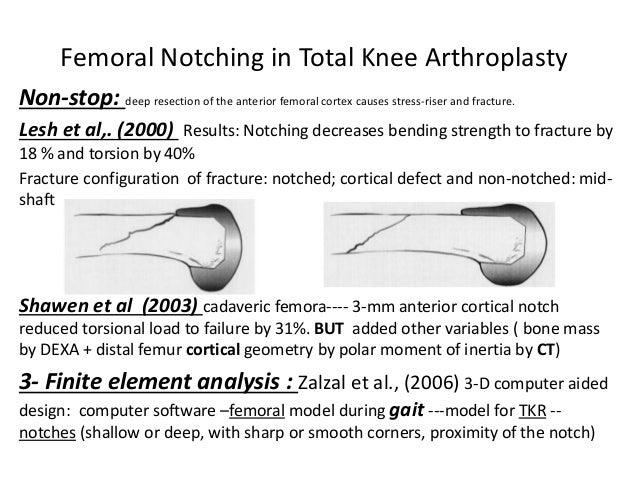 Femoral notching in total knee arthroplasty