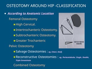 FEMORAL OSTEOTOMIES : SCHANZ, PAUWELS, MCMURRAY | PPTX