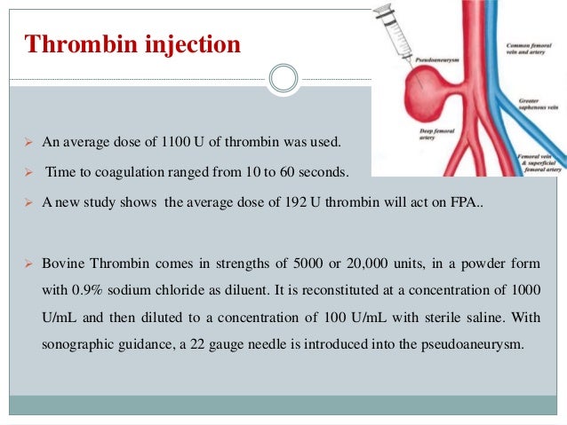 Femoral Pseudoaneurysm Thrombin Injection For