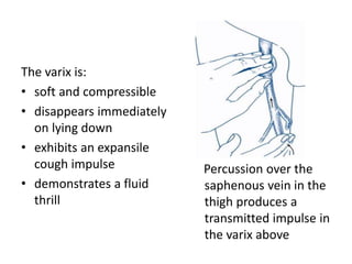 Femoral Triangle.pptx