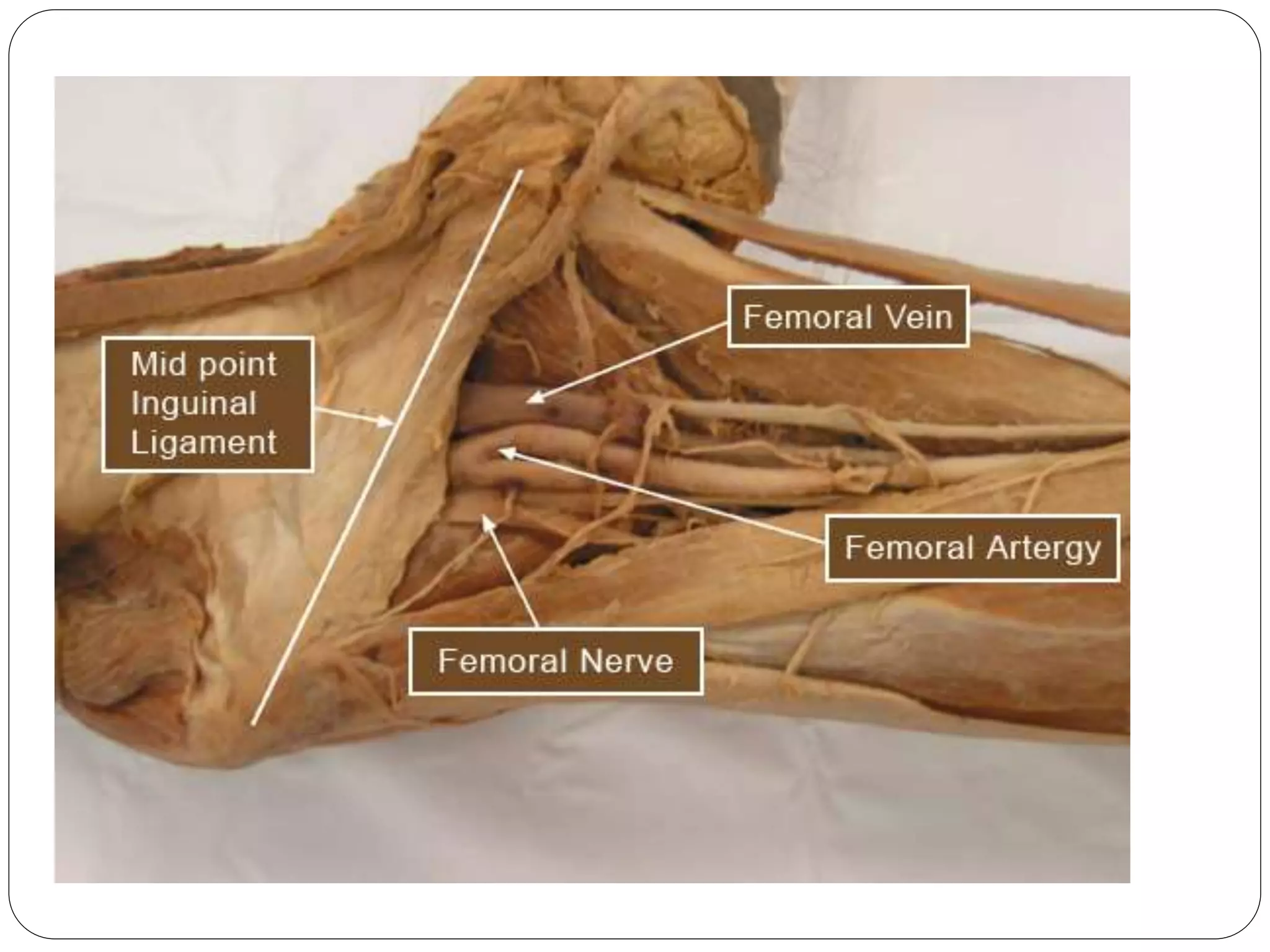 FEMORAL TRIANGLE.ppt