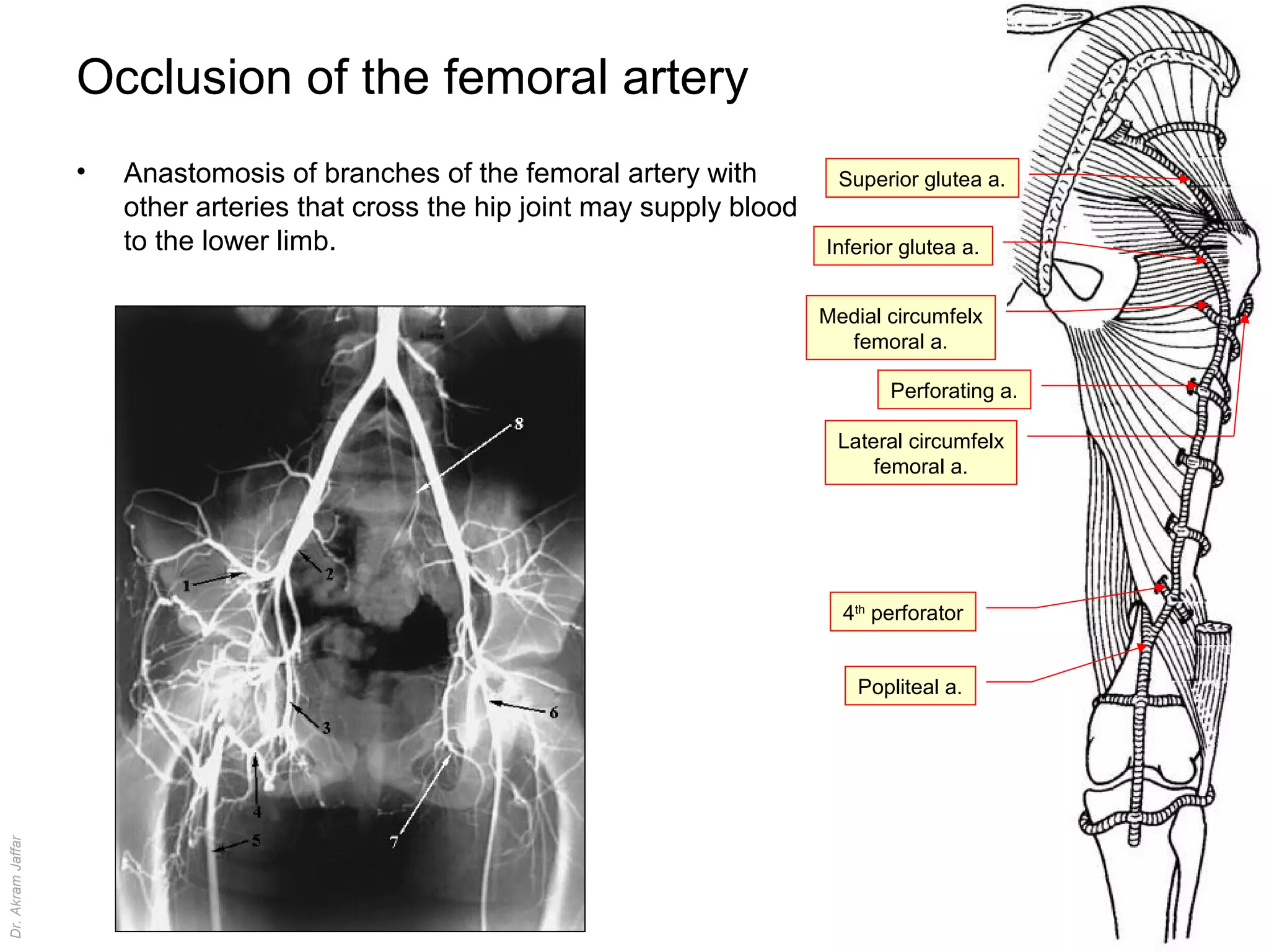 Femoral triangle and venous drainage in the lower limg | PPT