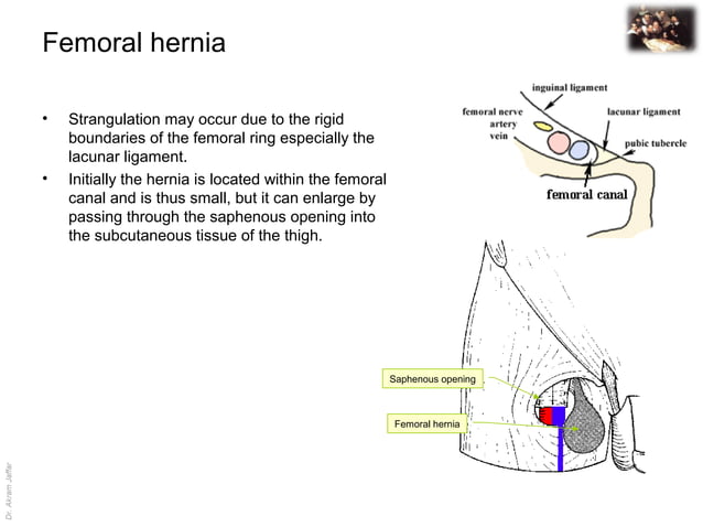 Femoral triangle and venous drainage in the lower limg | PPT