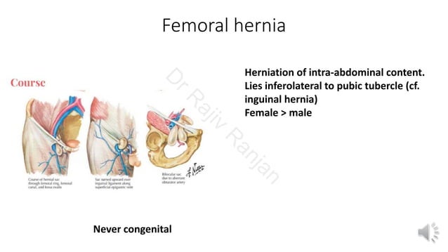 Femoral triangle & subsartorial canal | PDF
