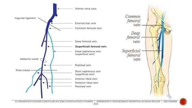 FEMORAL VEIN CANNULATION.pptx | Blood Disorders | Diseases and Conditions